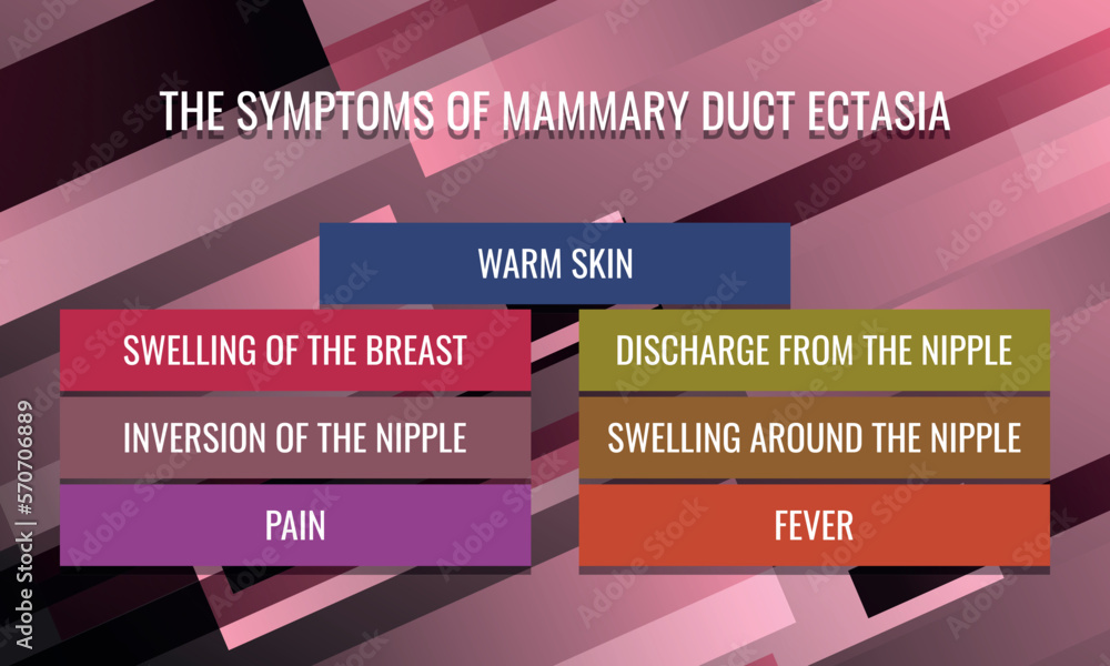 the symptoms of Mammary duct ectasia. Vector illustration for medical ...