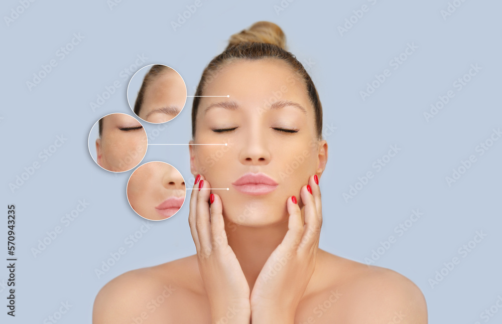 Dark spots, freckles,hyperpigmentation(melasma or chloasma),concept ...