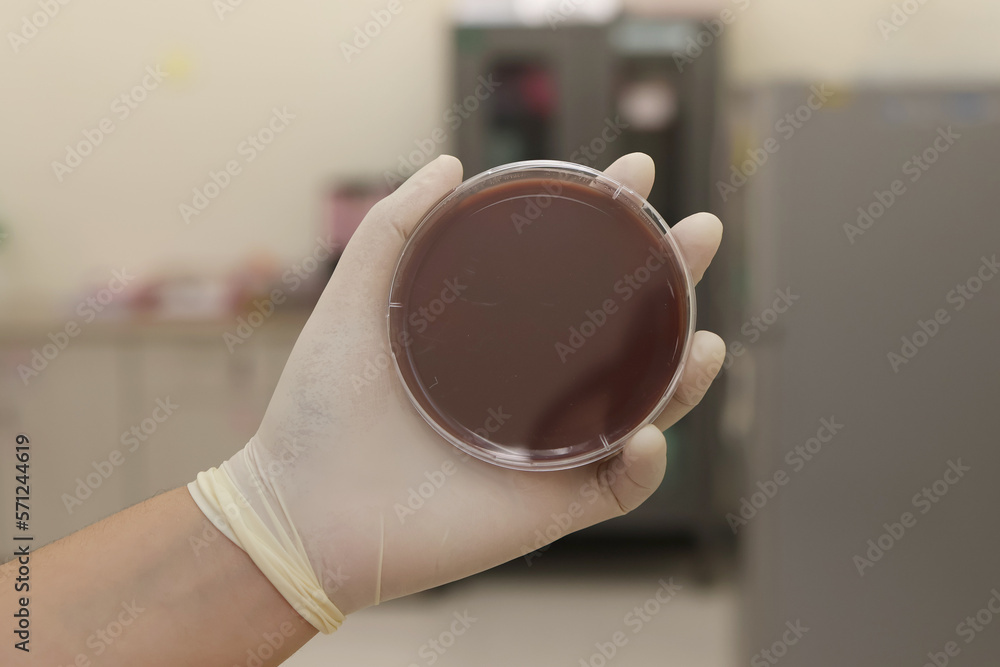 Scientist show selective blood agar culture medium plate for antibiotic ...