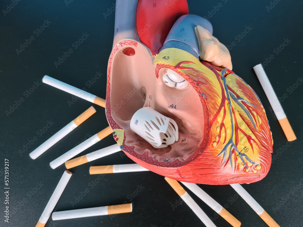 Cigarette smoking causes heart disease. Smoking and heart disease and ...