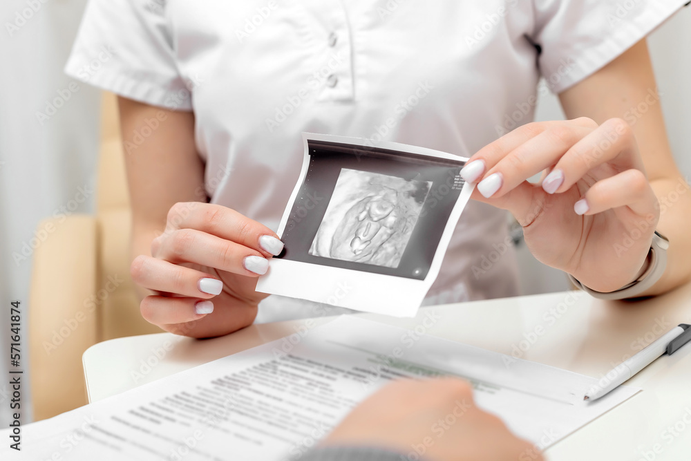 Ultrasound image of ovarian cyst. gynecological ultrasound, ovarium ...