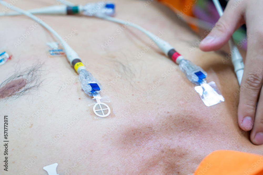 ECG or EKG of man with electrodes for electrocardiogram records on bed ...