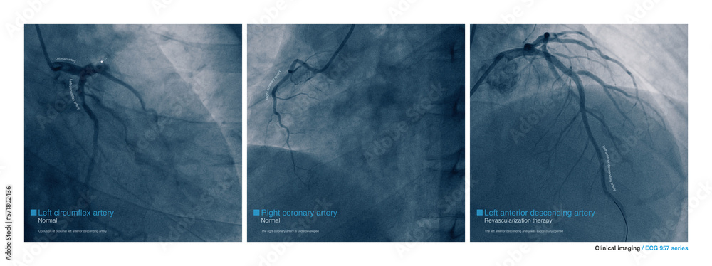 Male, 31 years old, admitted to hospital for chest pain for 1 hour ...