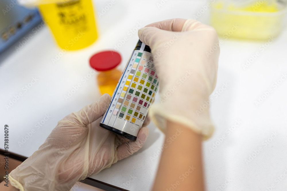 Reagent Strip for Urinalysis , Routine Urinalysis, check-up analysis in ...