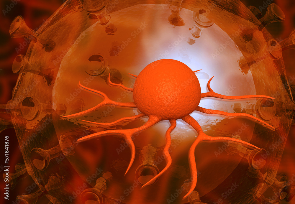 Poster Cancer cells diagram anatomy. 3d illustration.. – Wall Art ...