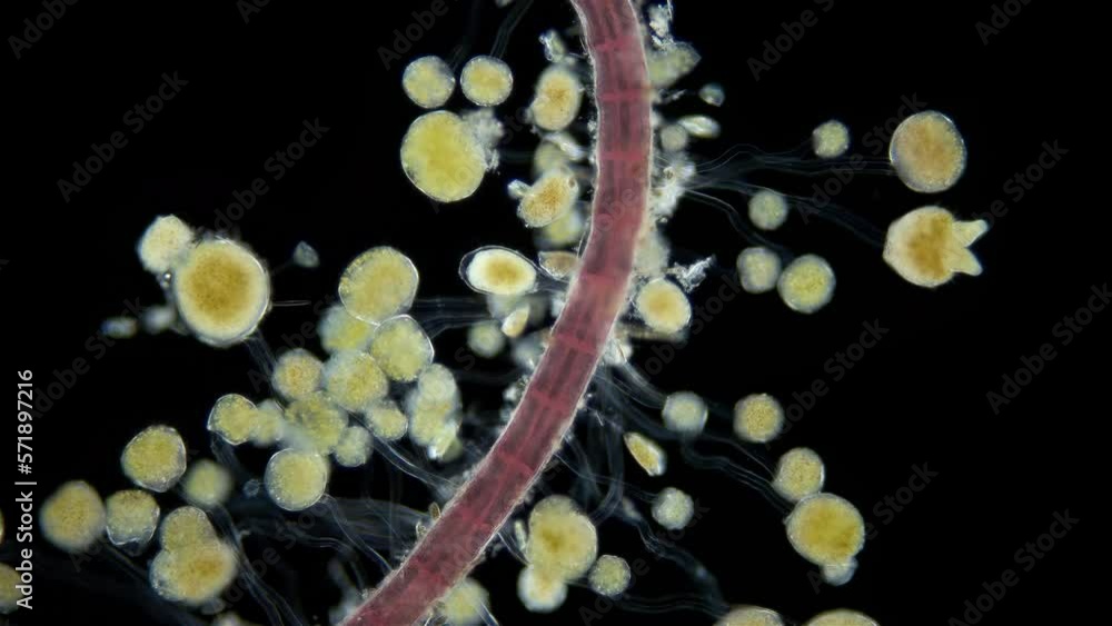 Infusorium Suctoria, order Exogenida under a microscope, possibly ...