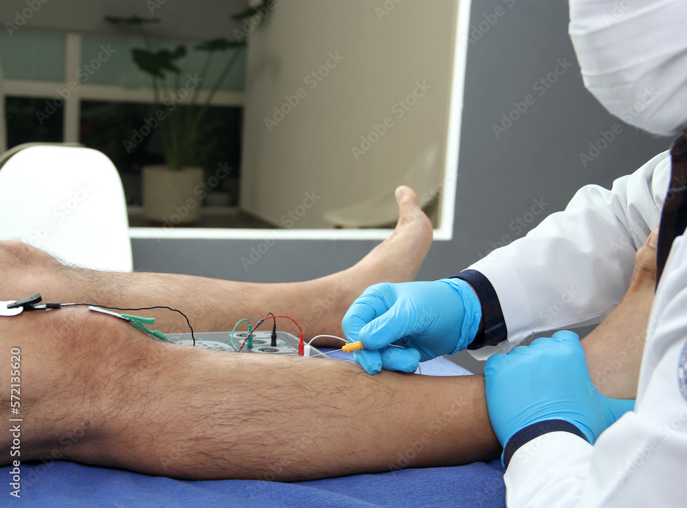 Electromyography in the lower limbs, graphic recording technique of the ...