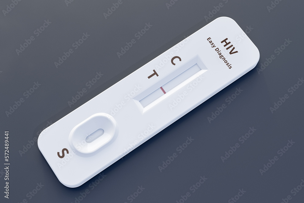 Colloidal gold test paper for HIV antibody detection Stock Photo ...