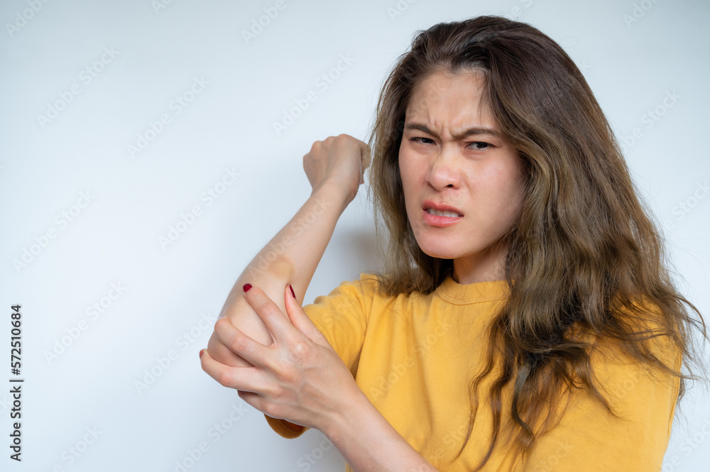 Worried woman having bruise occur on her skin. A bruise is a common ...