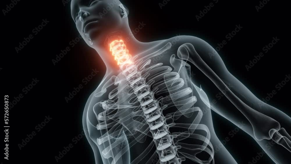 3D Rendering of a Medical Animation of the Cervical Vertebrae. X-ray of ...