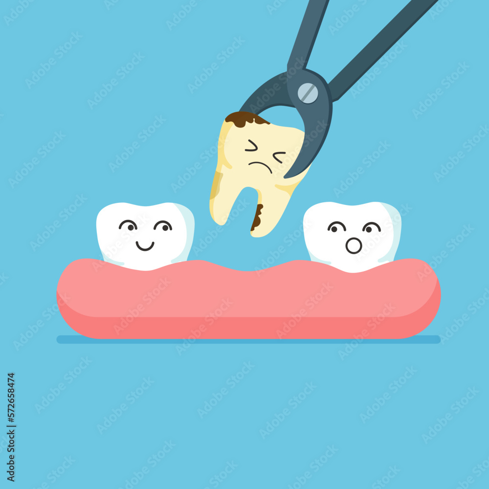 Cartoon tooth is removed by forceps. Teeth row with dental implant ...