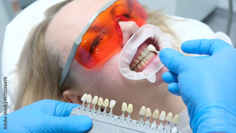 classical dental coloring for determining color of teeth Banner tooth ...