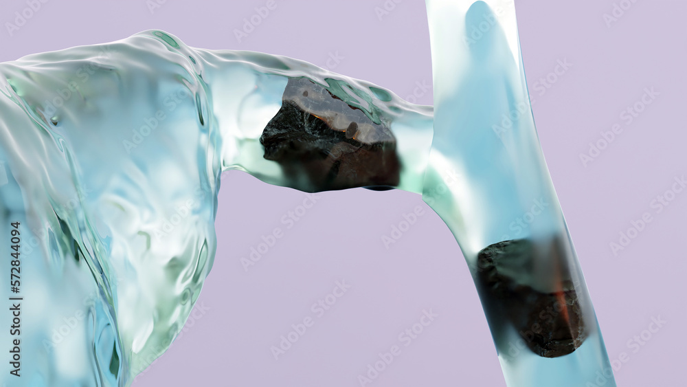 Gallstones in the gallbladderand bile duct, human silhouette and ...