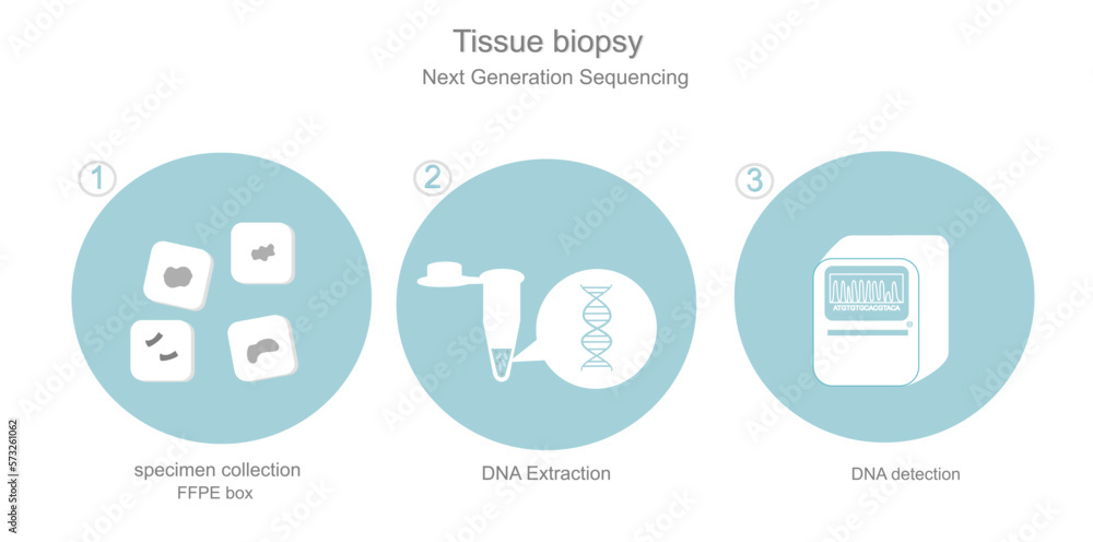 The workflow icon of DNA sequencing in Tissue biopsy with Next ...