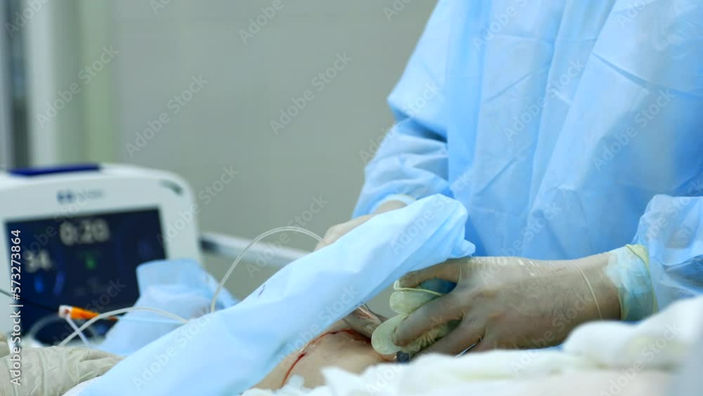 Controlling ultrasound process with sensor surgeon gently inserts ...