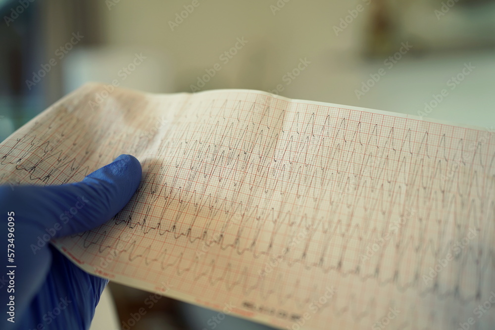 Poster Holding a real emergency ECG with a rhythmic tachycardia (180 ...