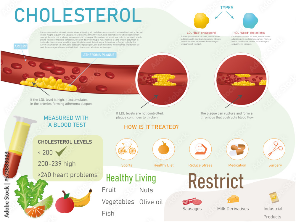 Cholesterol infographic, what it is, types, treatment and recommended ...