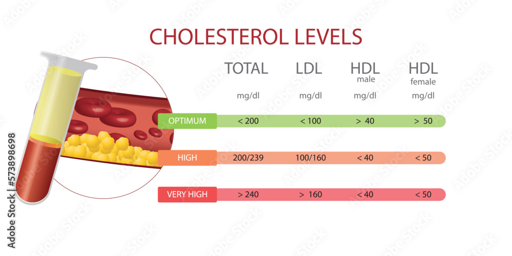 Vetor de Infographic of cholesterol levels, optimal low, and very high ...