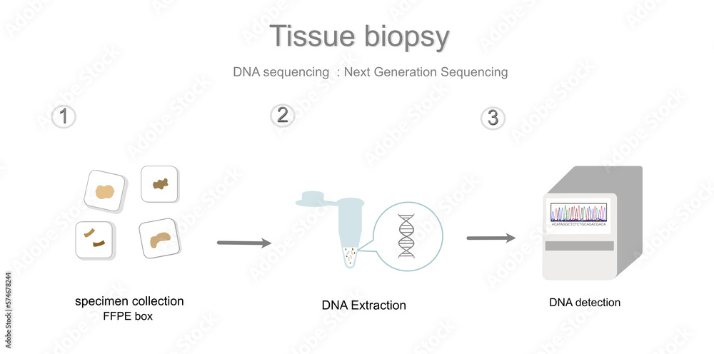 The workflow of DNA sequencing in the sample of tissue biopsy with Next ...