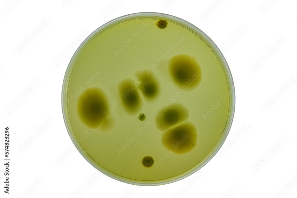 Colonies of different bacteria and mold fungi grown on Petri dish with ...
