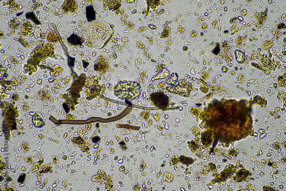 Naklejka soil microorganisms in a soil sample, soil fungus and bacteria ...