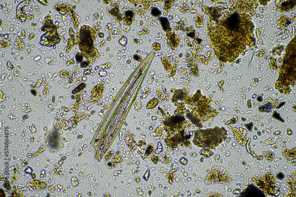 soil microorganisms in a soil sample, soil fungus and bacteria on a ...