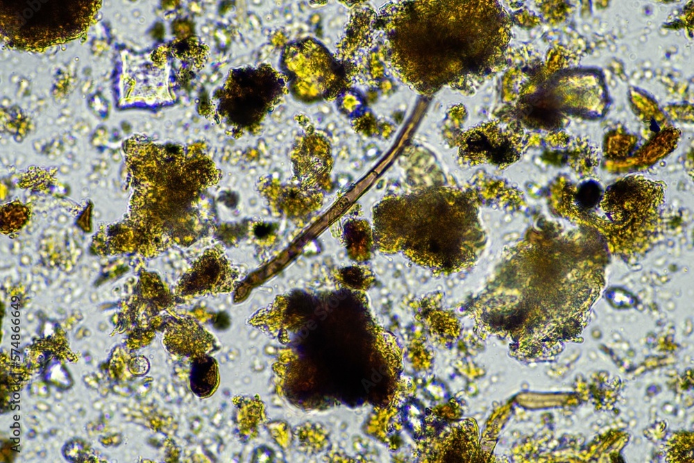 soil microorganisms in a soil sample, soil fungus and bacteria on a ...