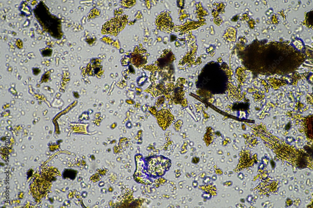 Foto de soil microorganisms in a soil sample, soil fungus and bacteria ...