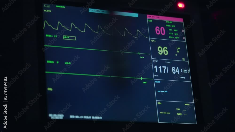 Handheld Close Up Shot Of A Patients Heart Rate Or Electronic Health Monitor With Heartbeats Or