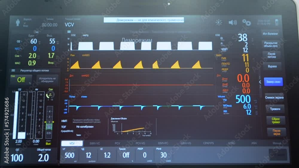 Utrasound image on the monitor close-up. Ultrasound Scan display ...