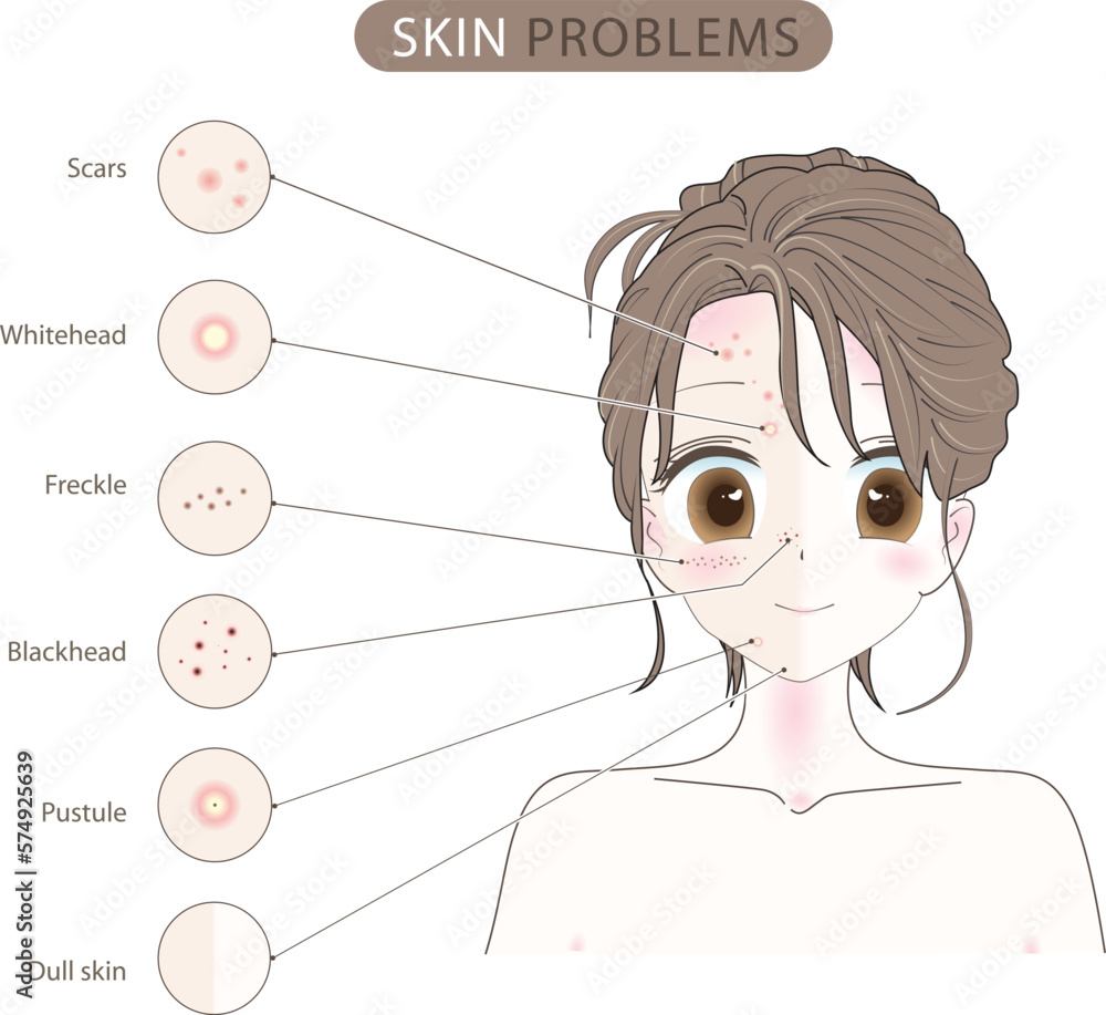 Troubled woman and set of most common female facial skin problems needs ...