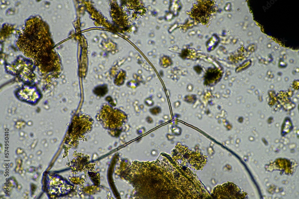 soil microorganisms in a soil sample, soil fungus and bacteria on a ...