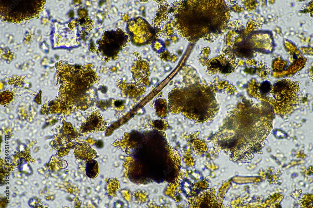 soil microorganisms in a soil sample, soil fungus and bacteria on a ...