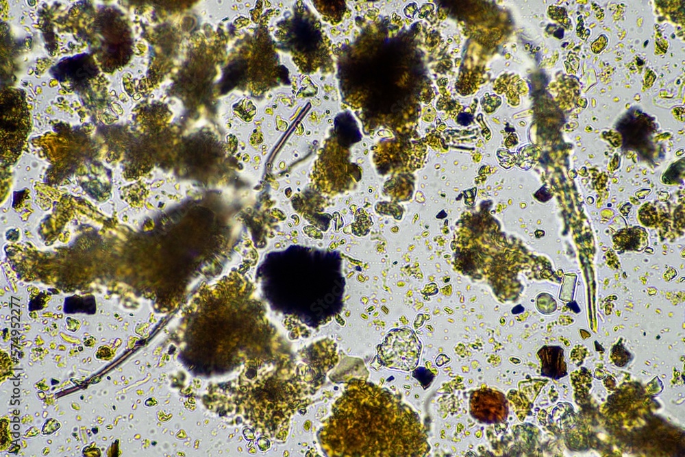 soil microorganisms in a soil sample, soil fungus and bacteria on a ...