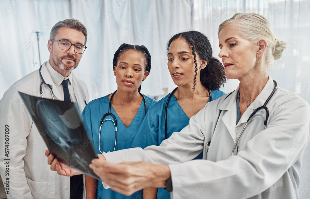 Xray, doctors and nurses, group and health with analysis of brain scan ...