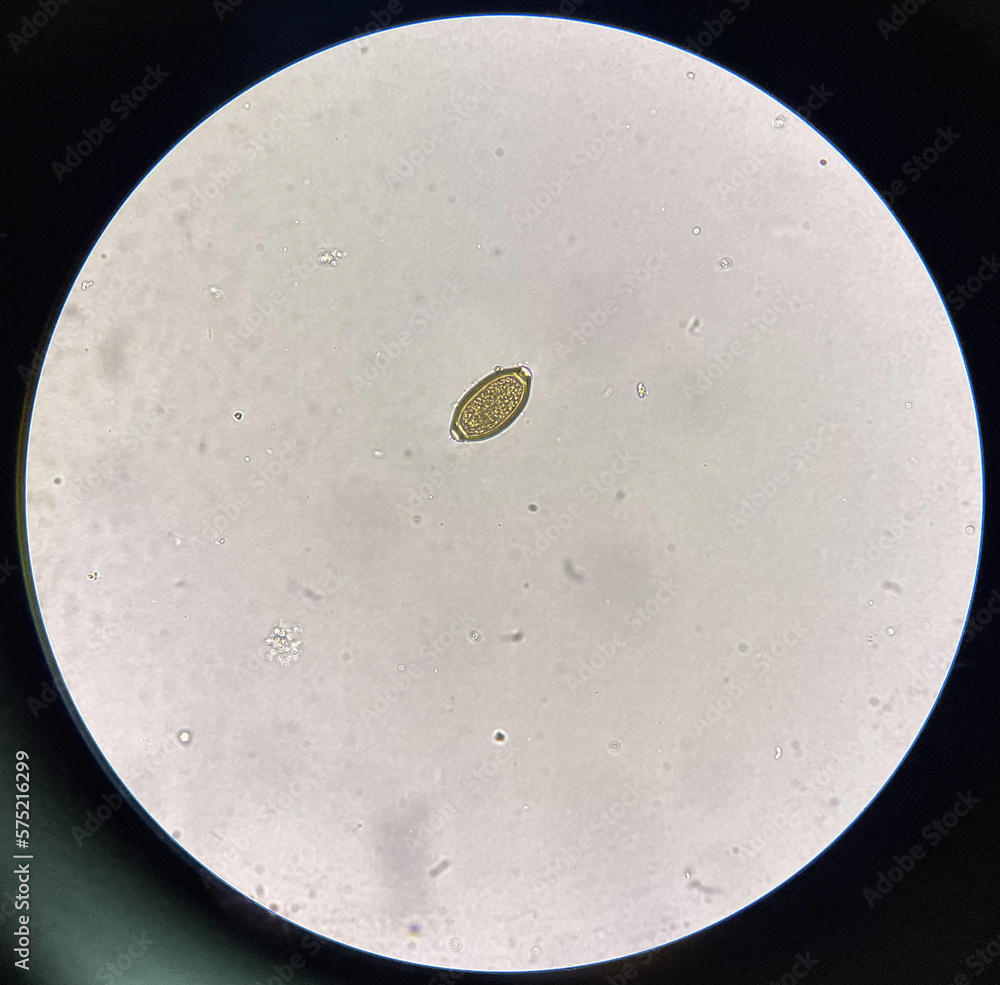 trichuris trichiura egg egg human parasite in stool examination Stock ...