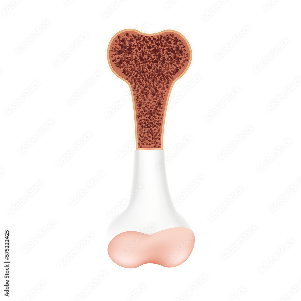 Osteoporosis human bone anatomy. Arthritis knee joint, Pain leg ...