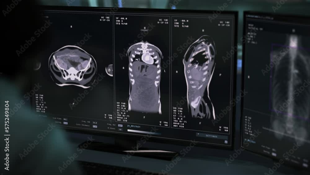 Disease Examination Machine Used By Doctor To Check Patients Organ ...
