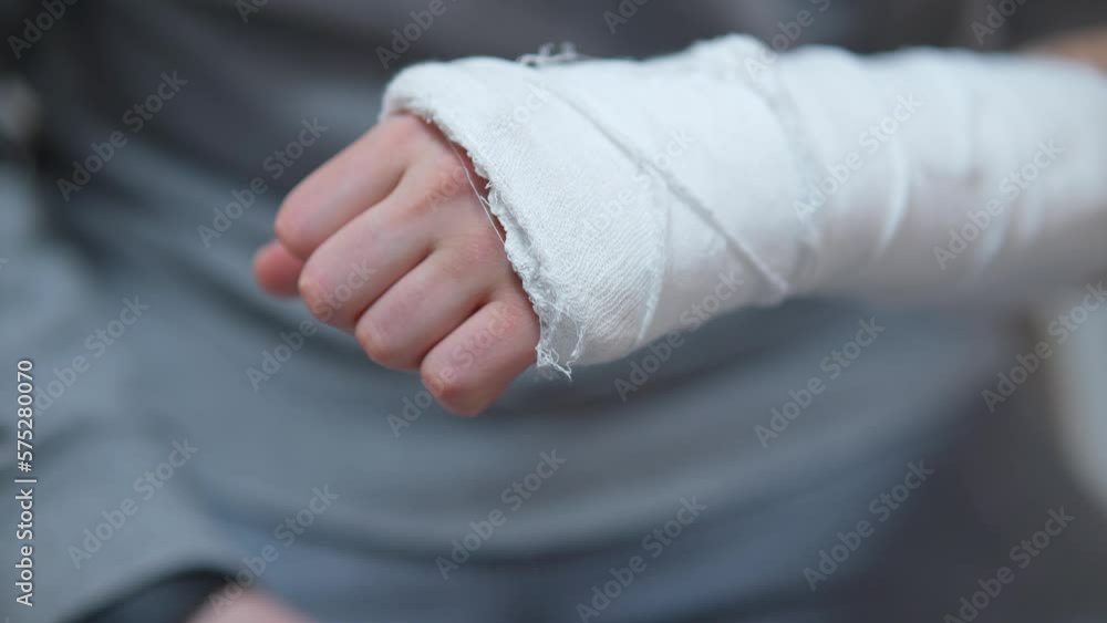 Man with plaster cast on arm. The difficulty of self-movement of the ...