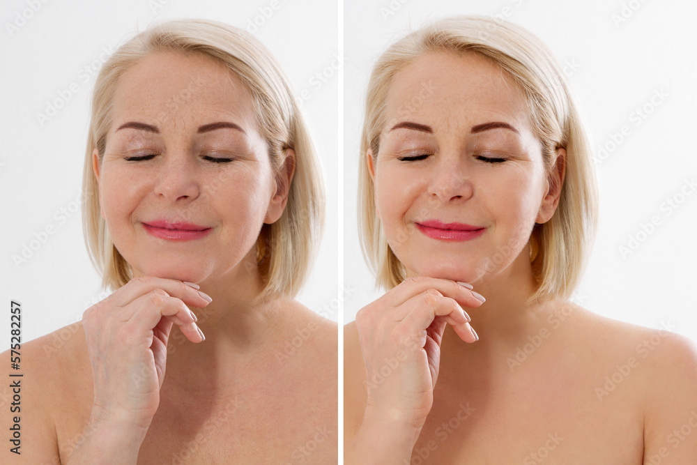 Closeup before after Beauty middle age woman face portrait. Before ...