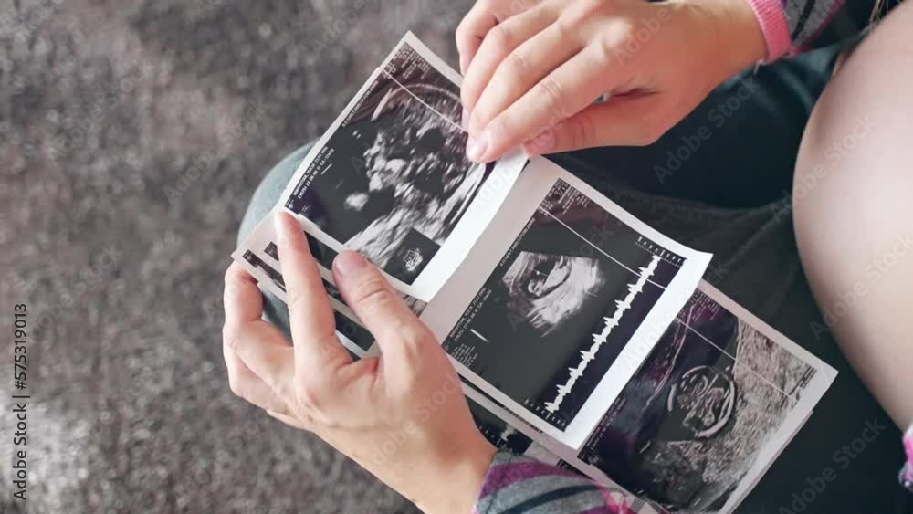 Video „Happy pregnant woman holding ultrasound scan pictures of her ...