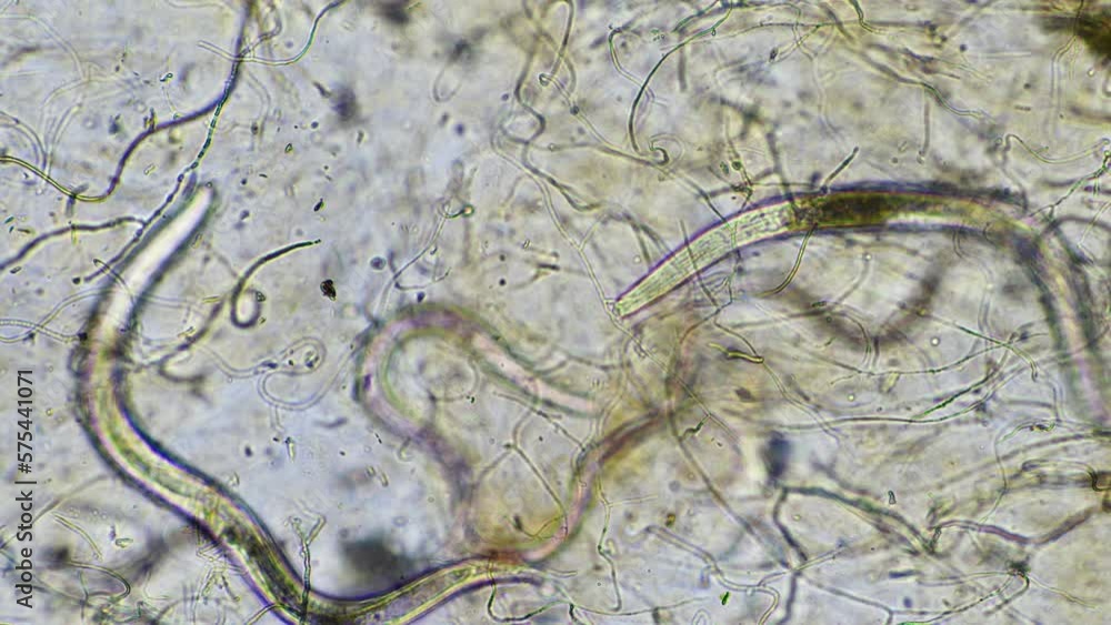 Vídeo do Stock: soil microorganisms including nematode, microarthropods ...