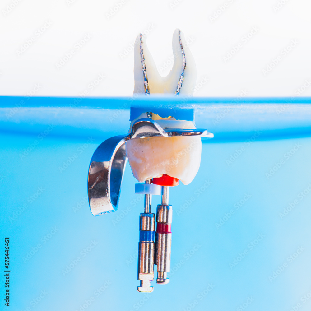 tooth slice macro capture during root canal treatment Stock Photo ...