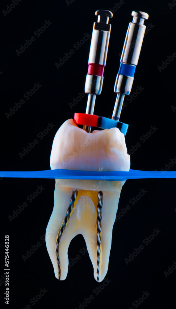 tooth slice macro capture during root canal treatment Stock Photo ...