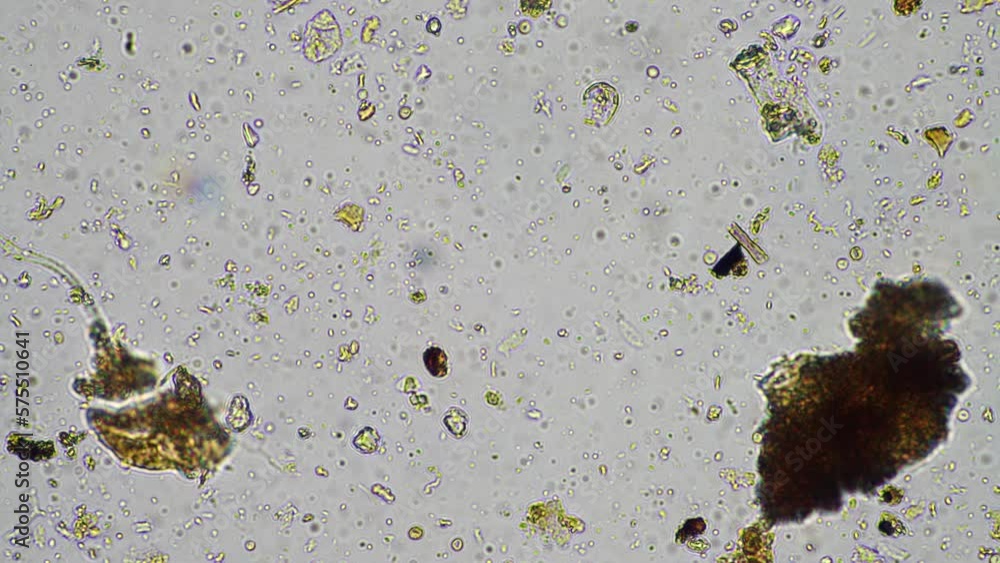 soil microorganisms including microarthropods, micro arthropod ...