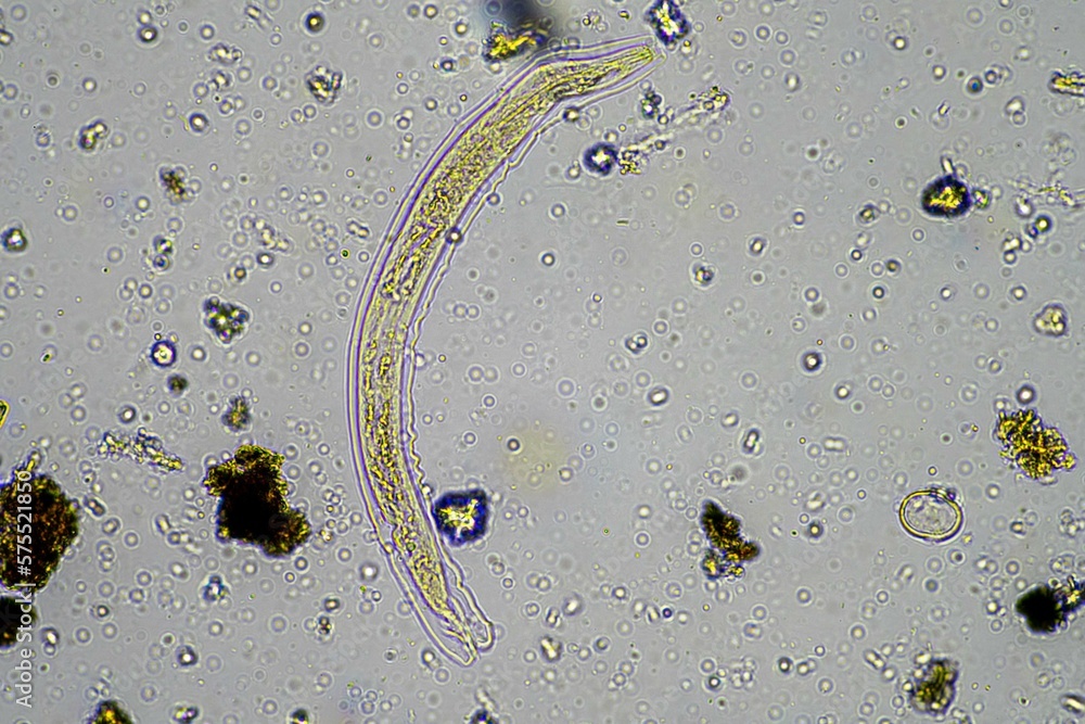 soil fungi and microorganisms in a soil and compost sample Stock Photo ...