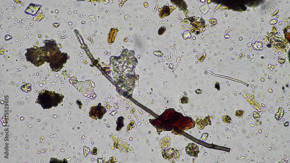 soil microorganisms nematode, microarthropods, micro arthropod ...