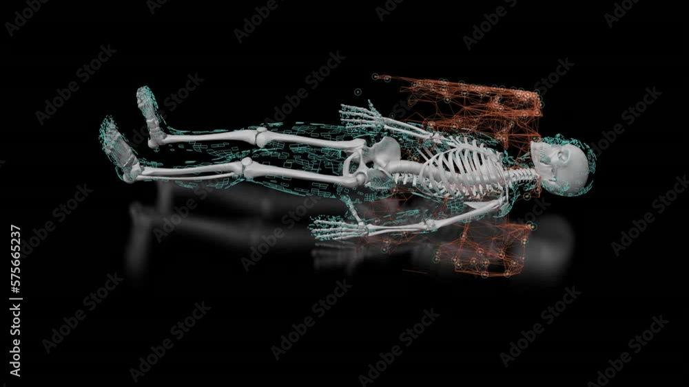3d Animation illustrating the procedure of a medical bone scan using ...