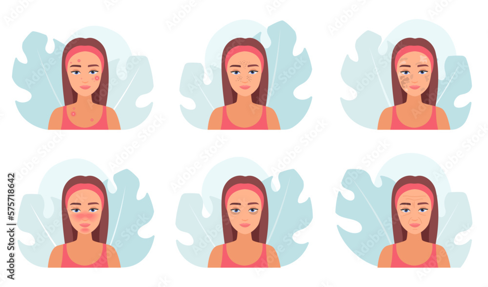 Skin problems set vector illustration. Cartoon infographic medical ...