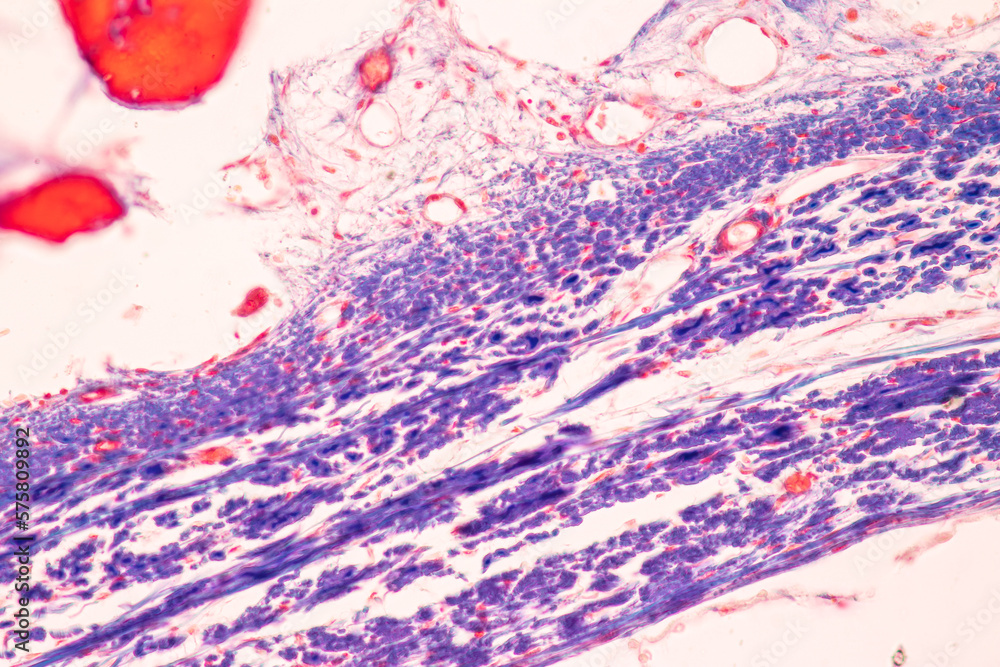 Adipose tissue human, Soft palate human, Bone human and Striated ...